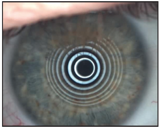 All-In-One Automated Measurement of Ocular Surface Par...