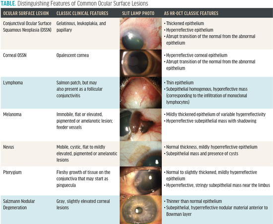 Performing an “Optical Biopsy” With HR-OCT