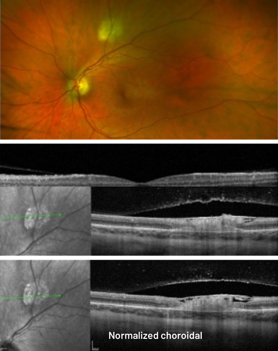 Collaborative Case #005: Things that Bug the Retina