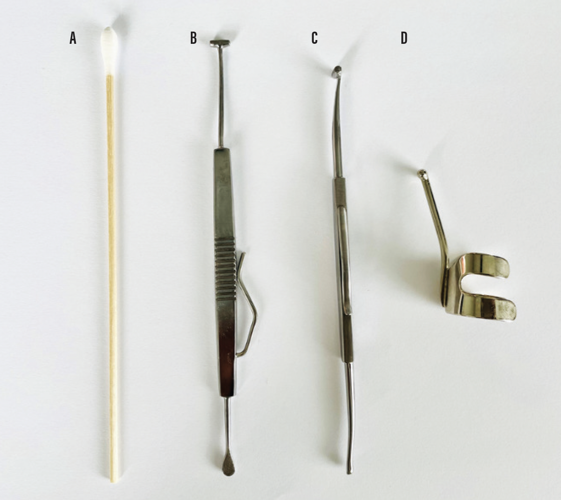 Clinical Tips to Perform Effective Scleral Indentation