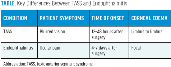 TASS After Cataract Surgery