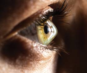 Identifying and Managing Corneal Dystrophies