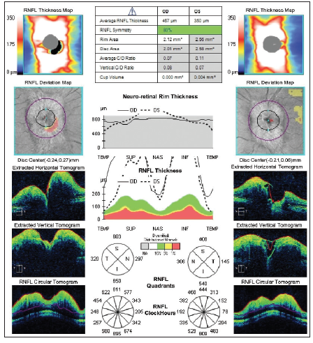 How to Spot a Neurologic Condition