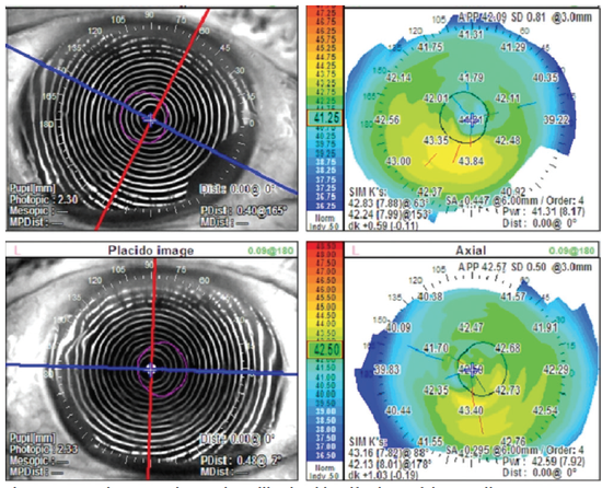 Updates In Dry Eye Disease: Diagnosing and Treating Pa...