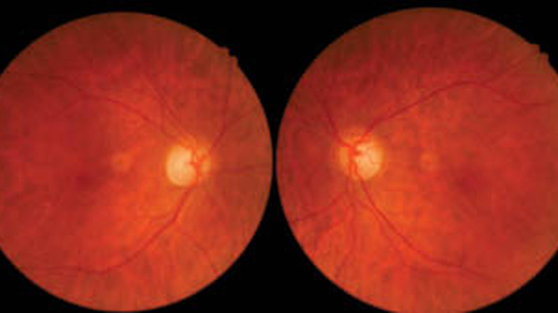 New Year, New Vision - Modern Optometry