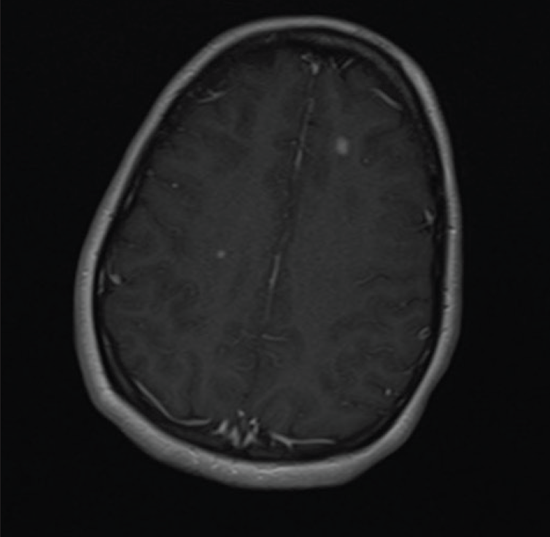 A Medical Optometrist’s Guide to MRI