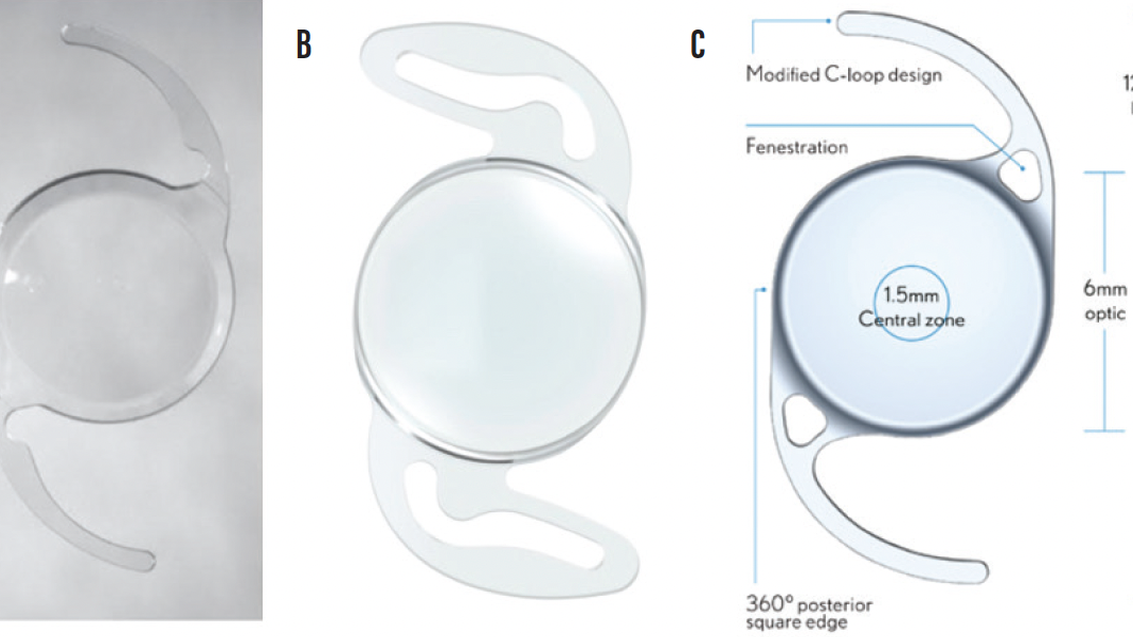 Innovations in IOL Technology