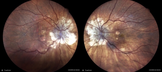 GA Case Compendium: Collaborative Care to Improve Patient