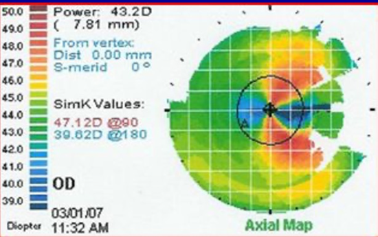 Collaborative Case #012: Best Management of a Visually Si