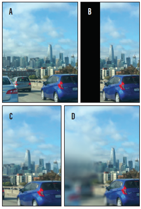 A Lesson on Neurologic Visual Field Loss