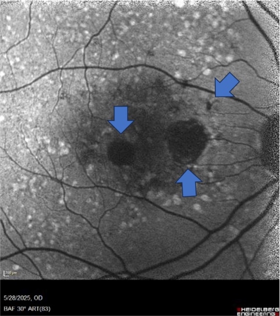 GA Case Compendium: Challenges in Patient Education and T
