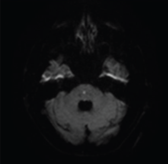 A Medical Optometrist’s Guide to MRI