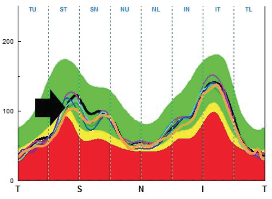 Glaucoma Suspect Identified: Now What?