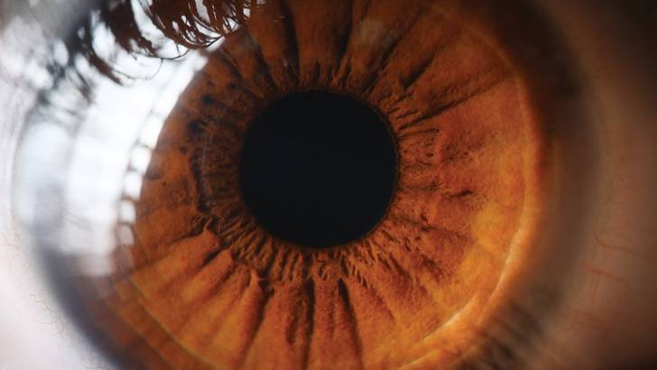 Scleral Lenses for Post-Corneal Transplant