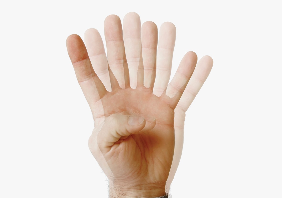 An Unusual Sudden Onset of Diplopia
