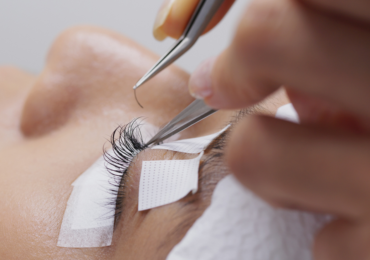 Managing Demodex Blepharitis in Eyelash Extension Wearers