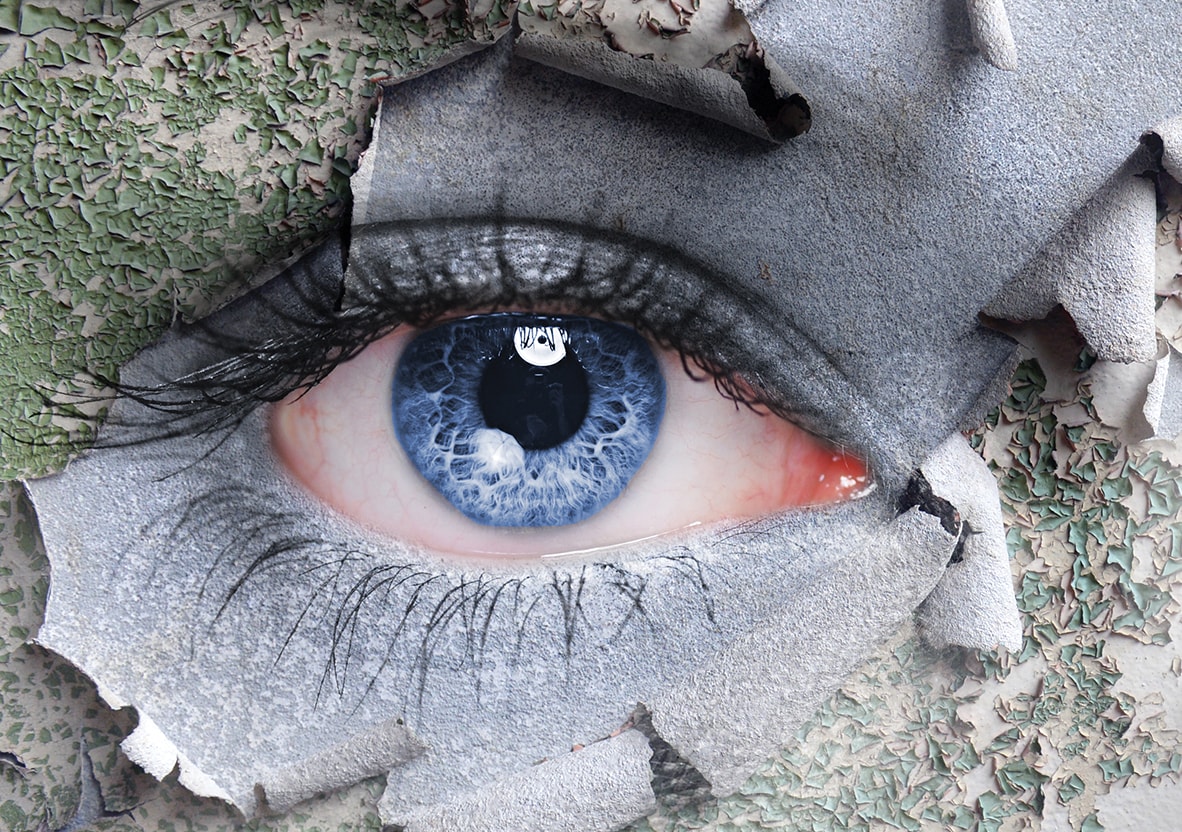 Managing Dry Eye Flares