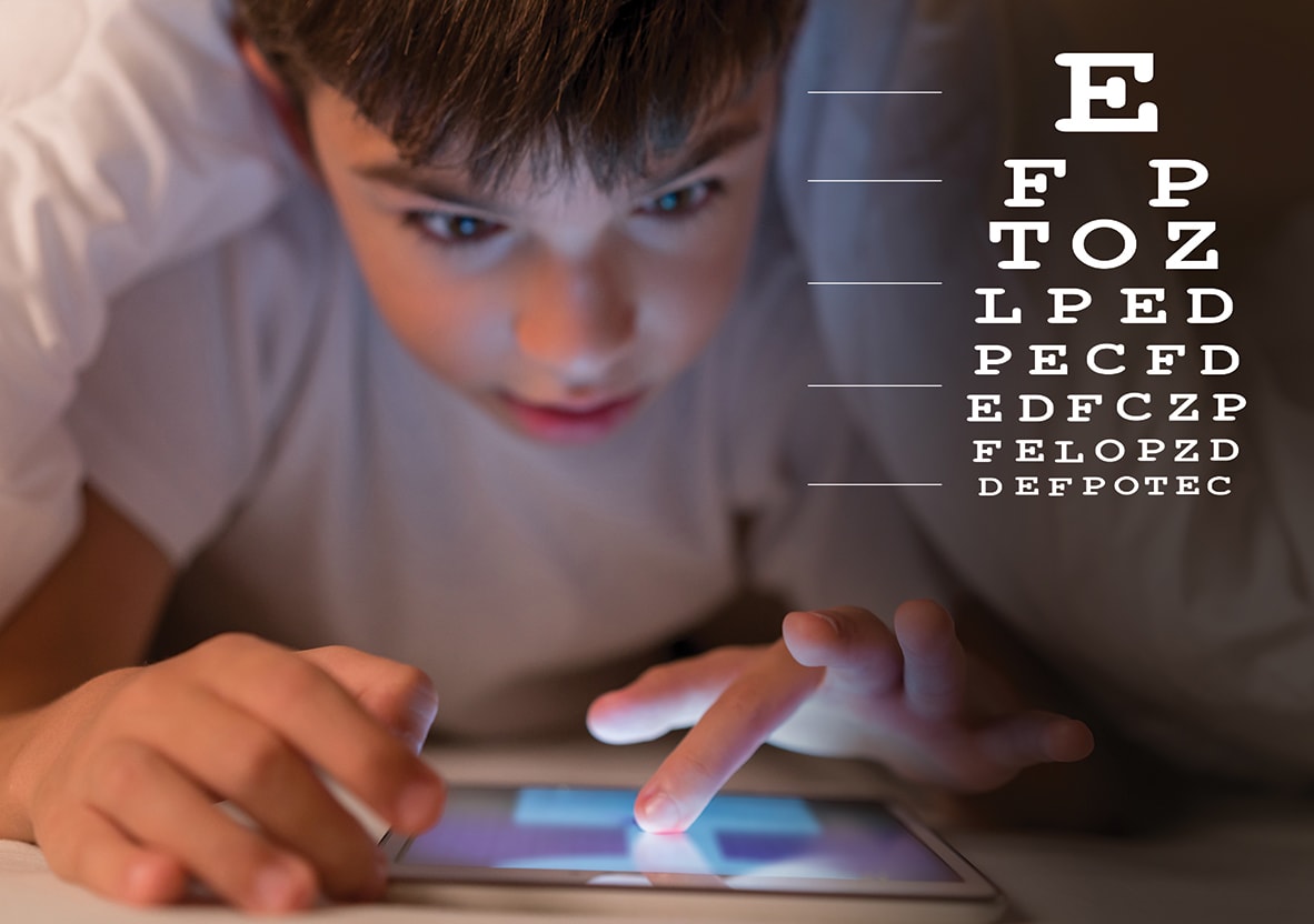 Myopia Control With Multifocal Contact Lenses