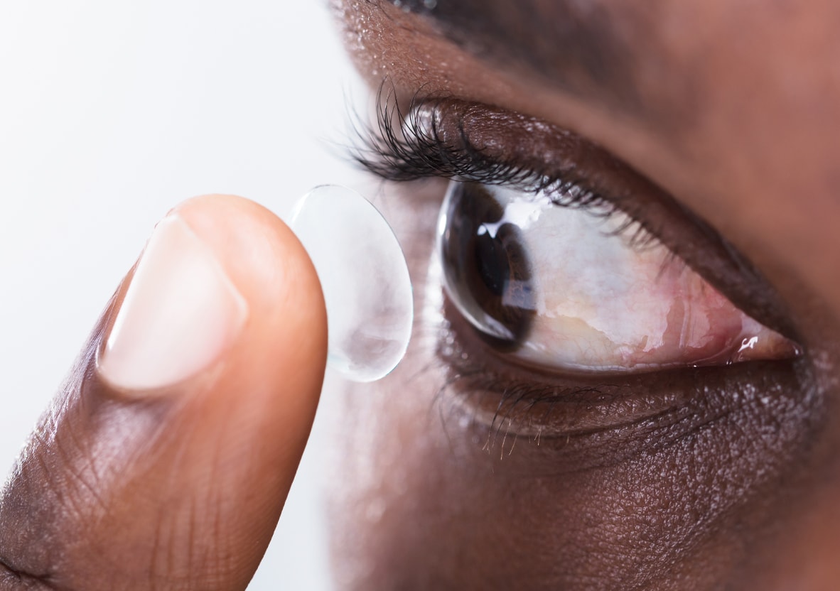 The Importance of Managing Astigmatism in Contact Lens...