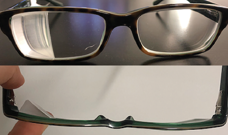 Consulting Patients With Hemianopic Visual Field Cuts