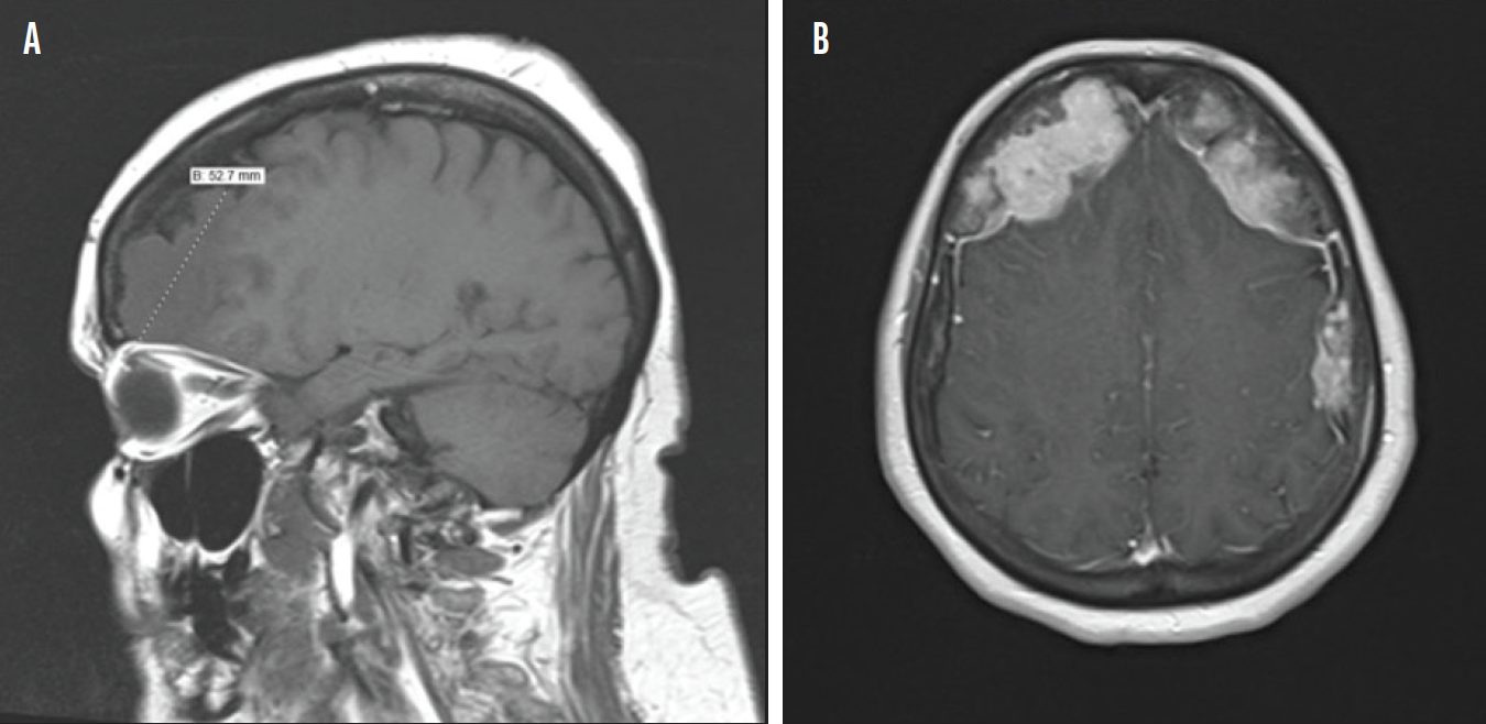 A Medical Optometrist’s Guide to MRI