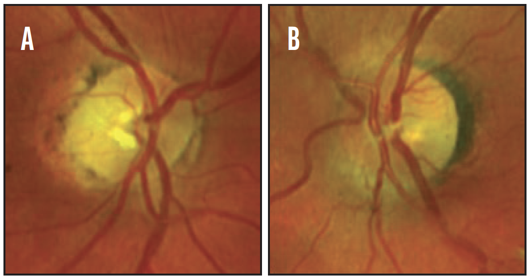 A Medical Optometrist’s Guide to MRI