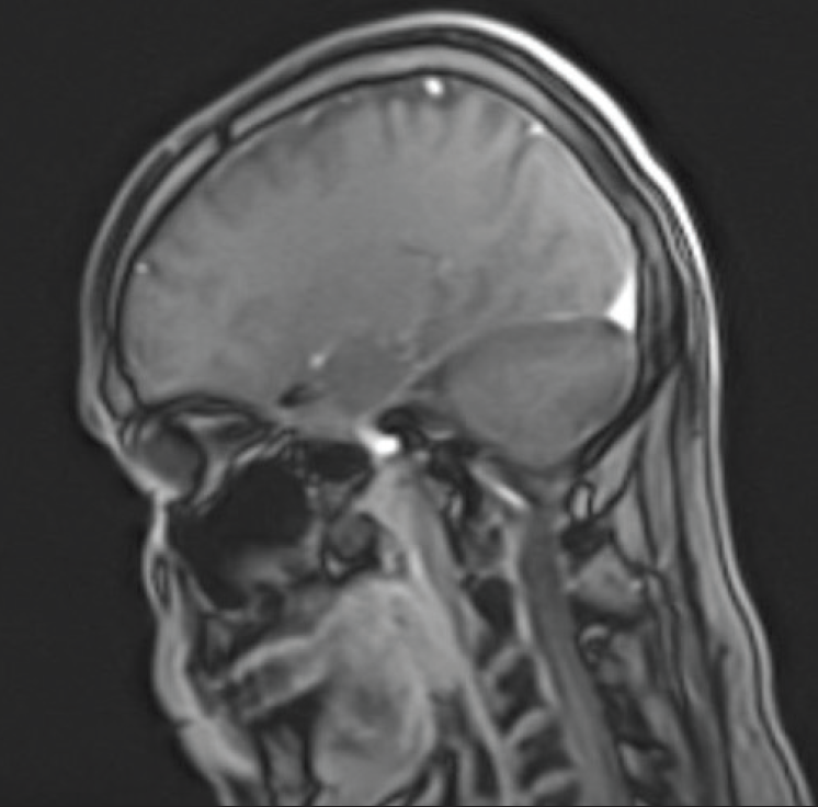 A Medical Optometrist’s Guide to MRI