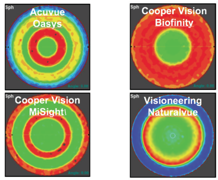 Myopia Control With Multifocal Contact Lenses