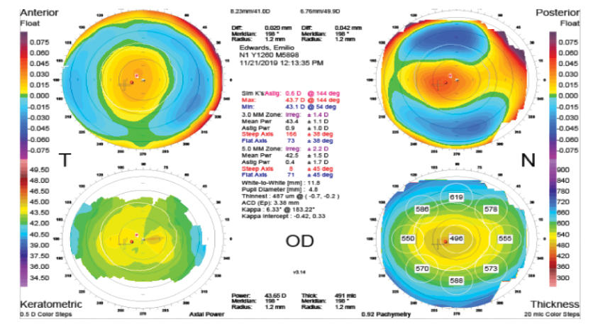 AvaGen™, The Genetic Eye Test in Modern Practice