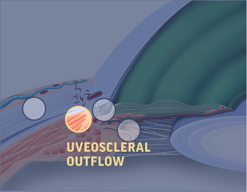 Glaucoma Pipeline 2026 - ModernOD