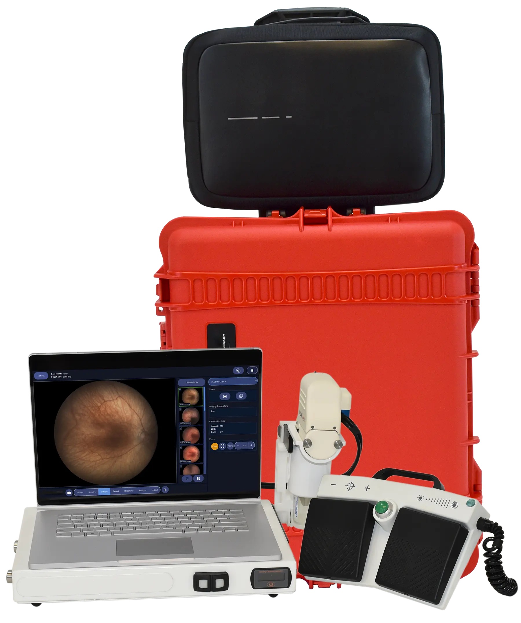 NeoLight’s Icon Go With Fluorescein Angiography Capabilities Cleared by ...