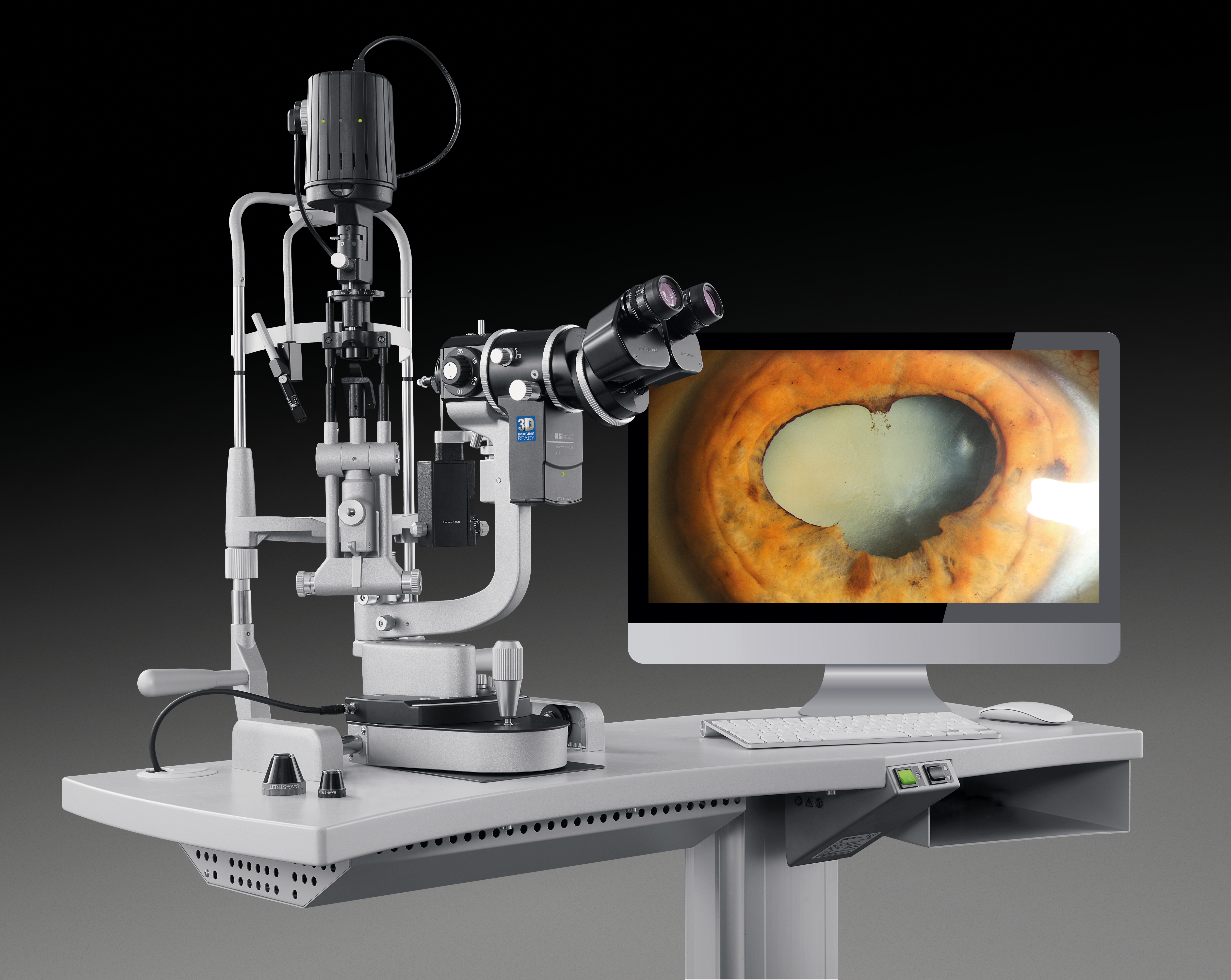 Haag-Streit Launches 3D Imaging Option for the Imaging Module 910 - - Modern Optometry